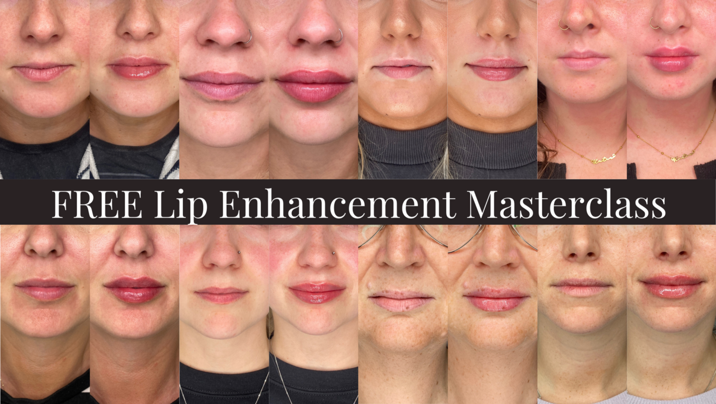 FREE Lip Filler Masterclass