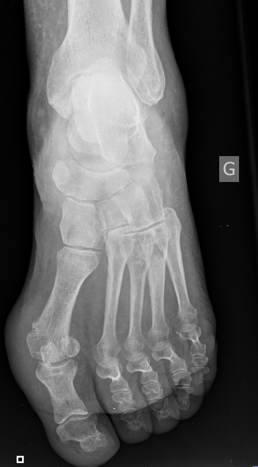 Pain ++++++ · MSK Radiology