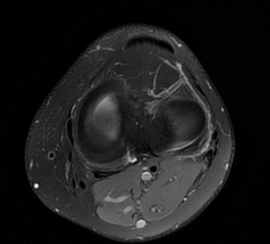 Knee MRI case · MSK Radiology