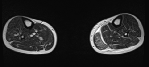 Leg MRI · MSK Radiology