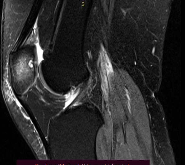 knee MRI · MSK Radiology