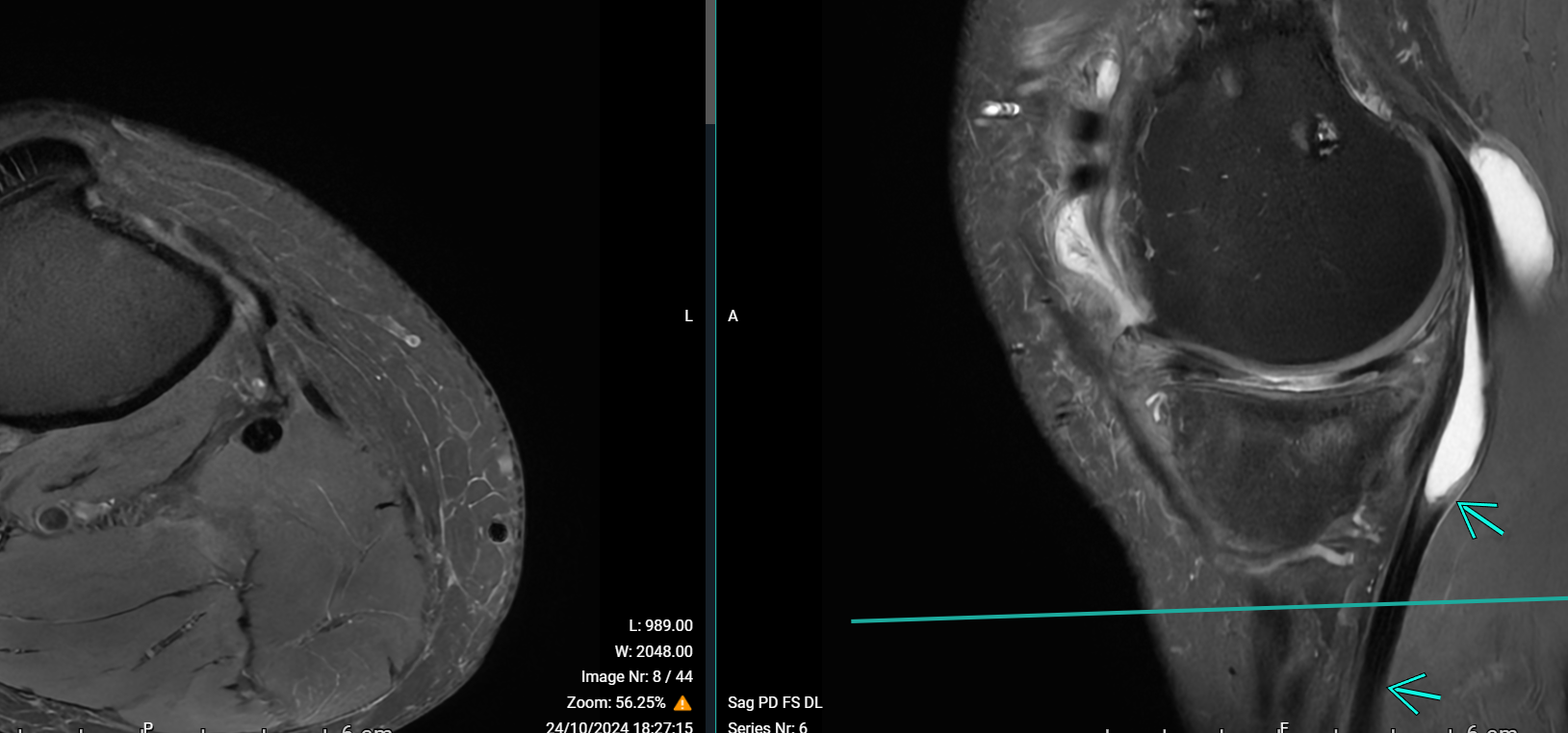 Find the resource · MSK Radiology