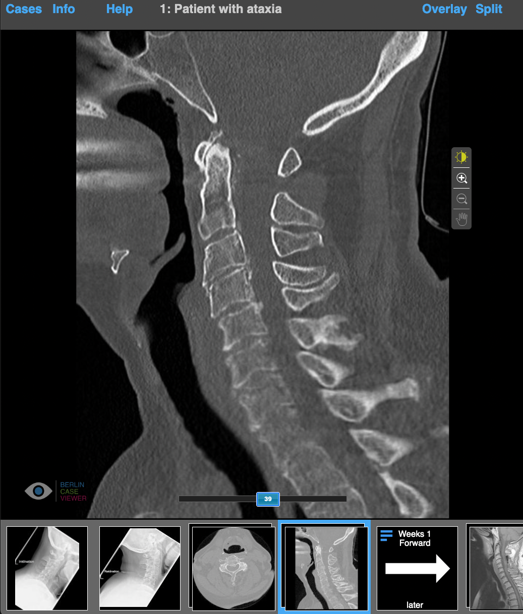 A common case? · MSK Radiology