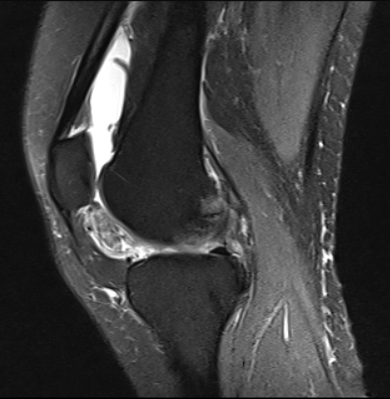 Knee case (another one) · MSK Radiology School