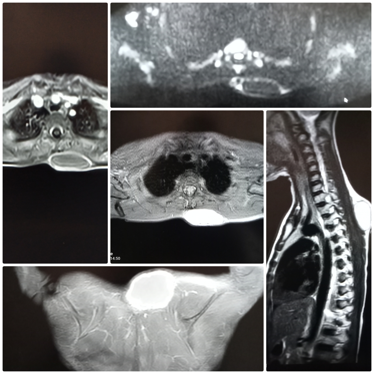 Back pain · MSK Radiology School