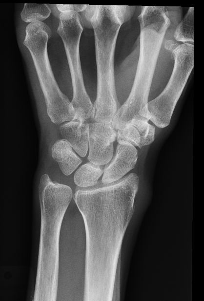 A case of radial-sided wrist pain · MSK Radiology School