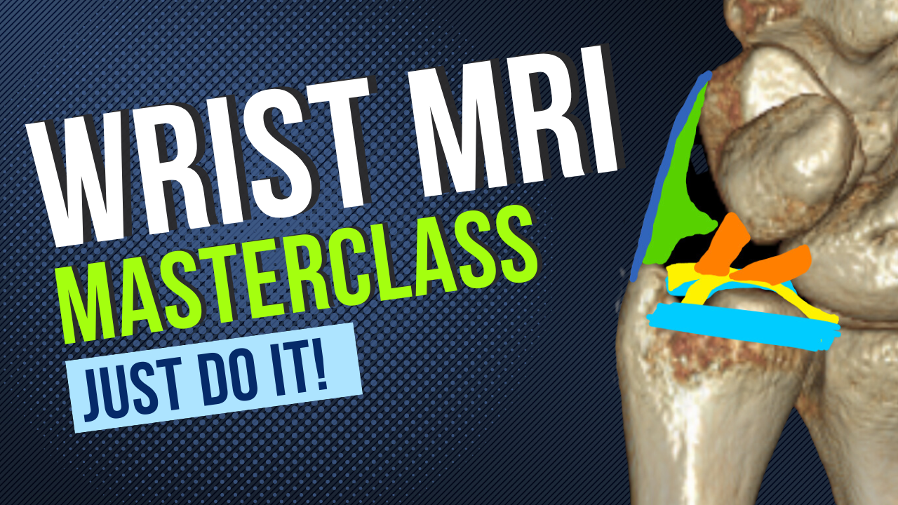 Wrist Masterclass for Free (level 5 or higher). · MSK Radiology