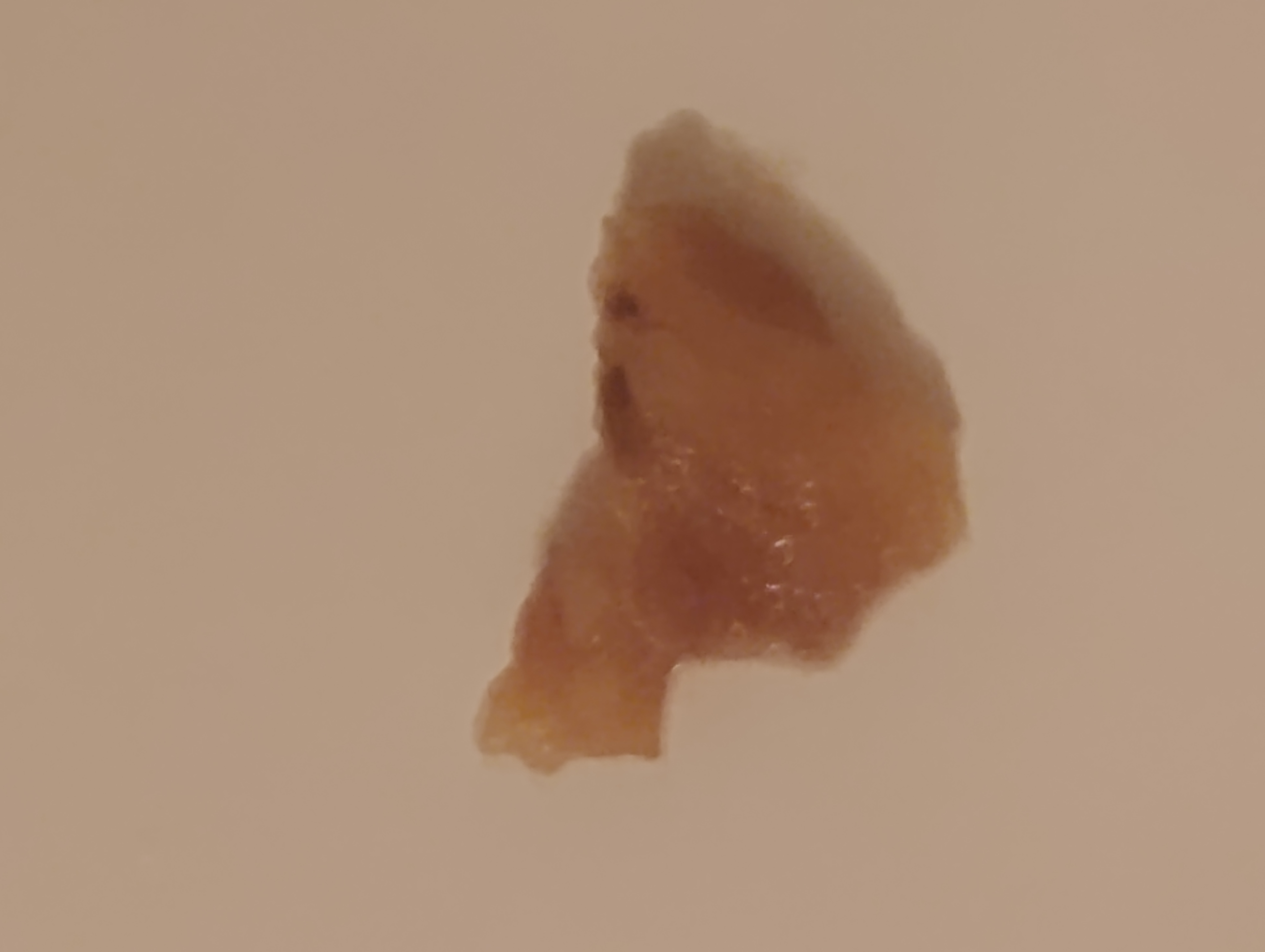 Today... parasites · Chlorine Dioxide Testimonies