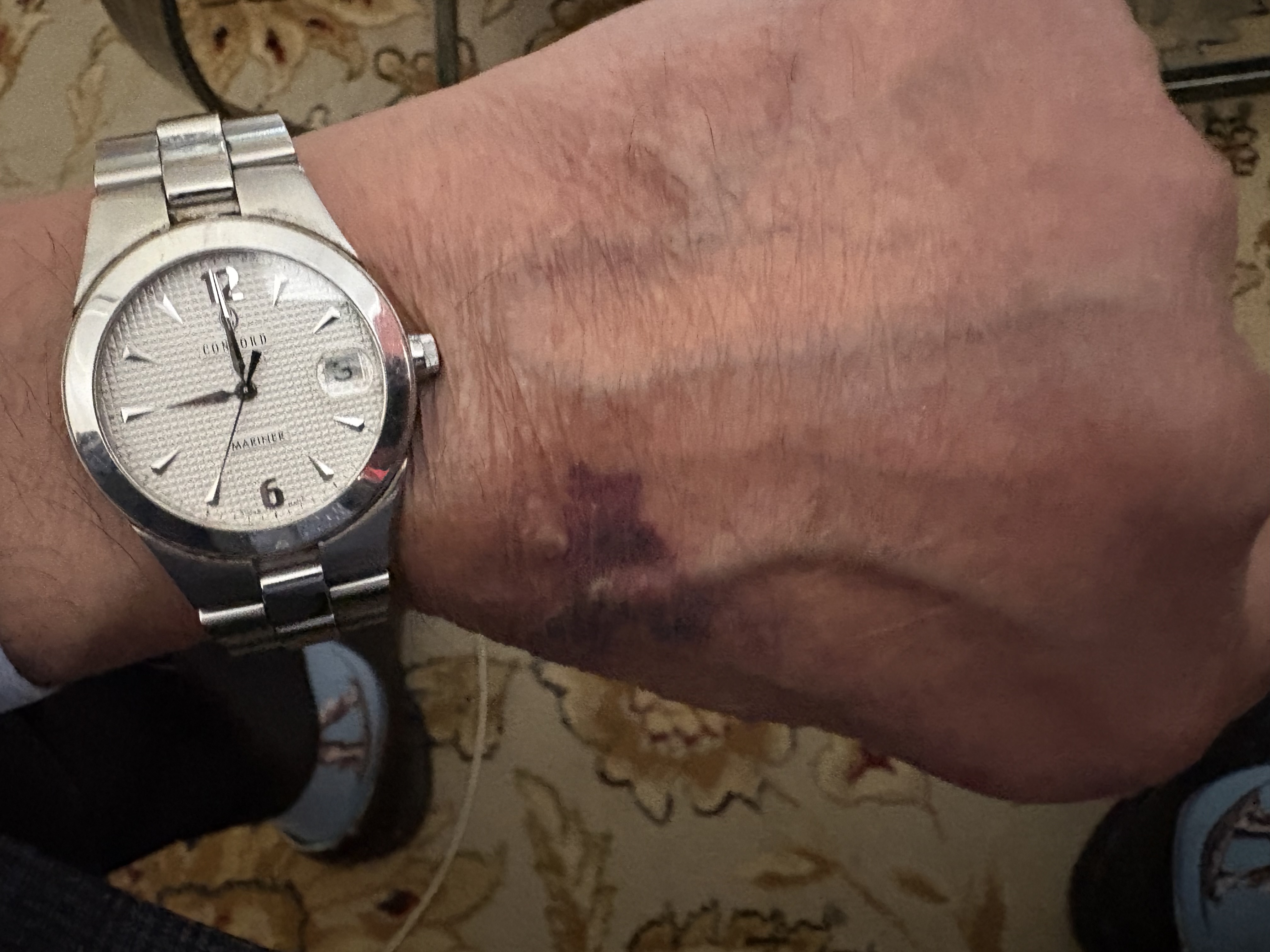 Everyday Classic · Watch Lover | Community