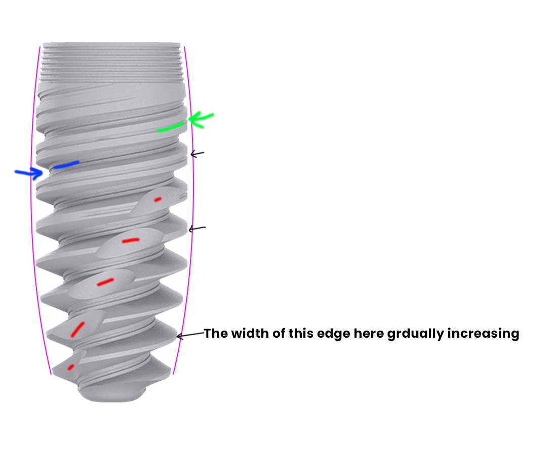 Need help to design a Dental Implant · Creative 3D Community