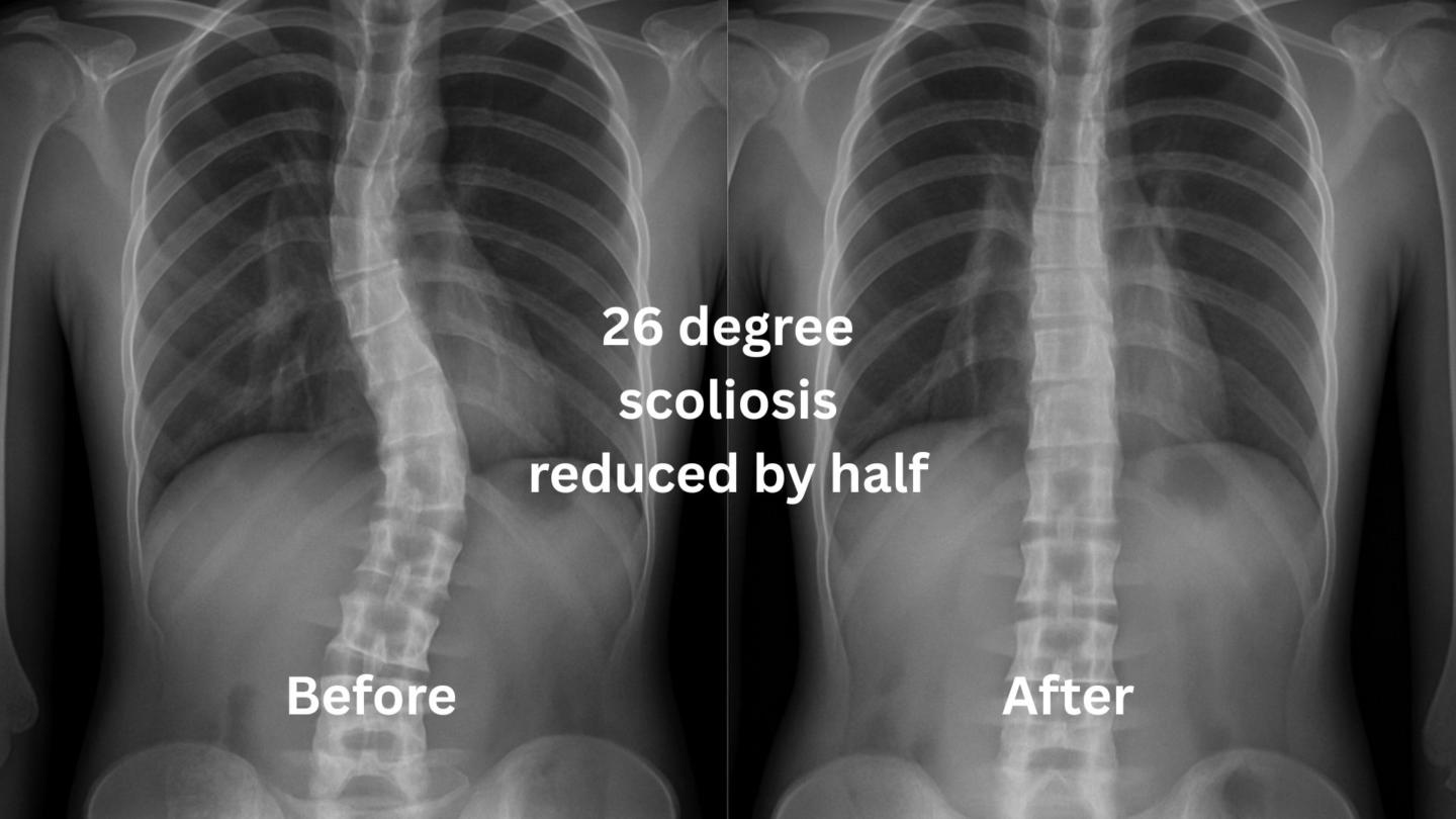 The Bulletproof Body