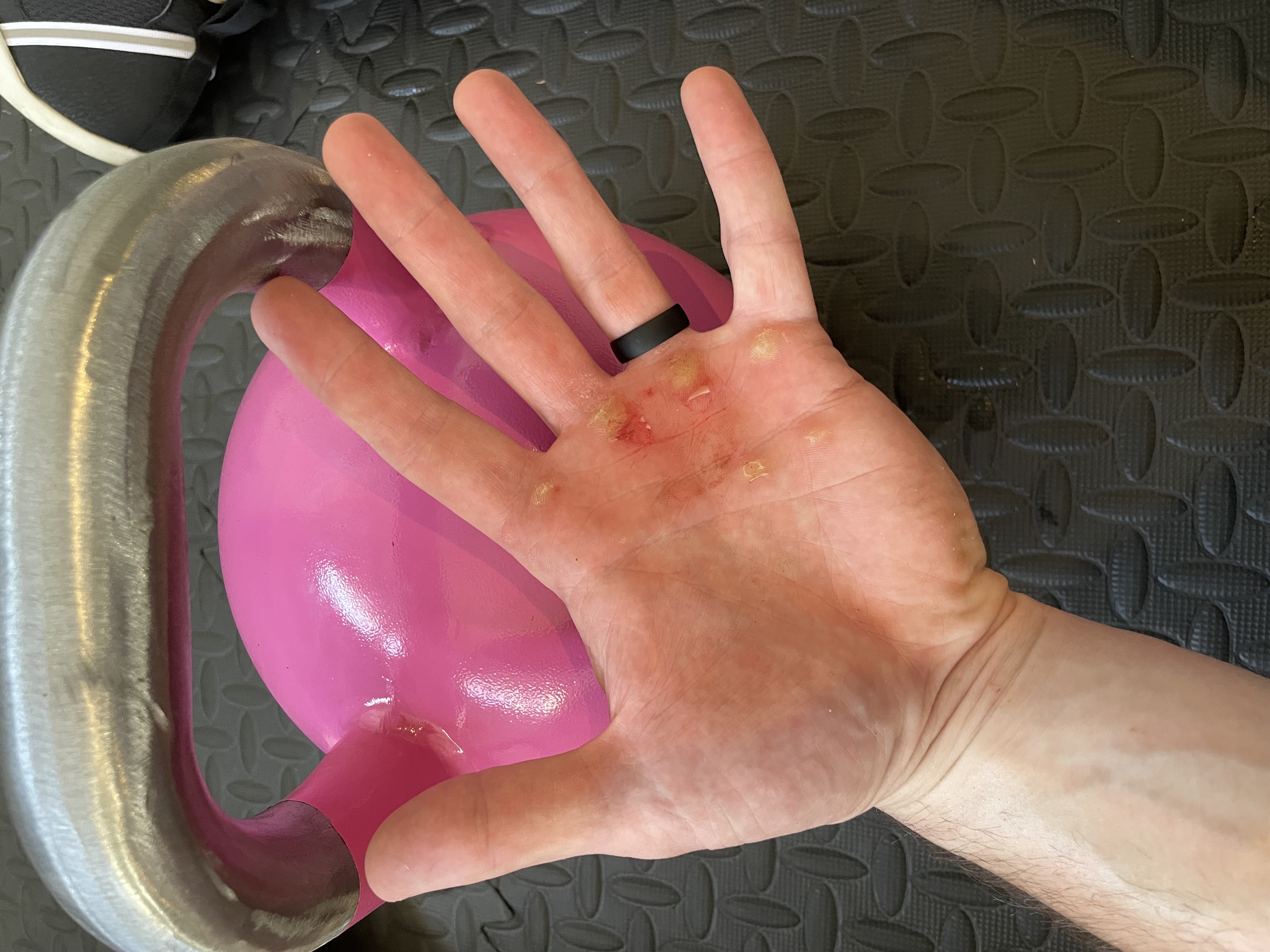 Battle Scars · Kettlebell Warriors